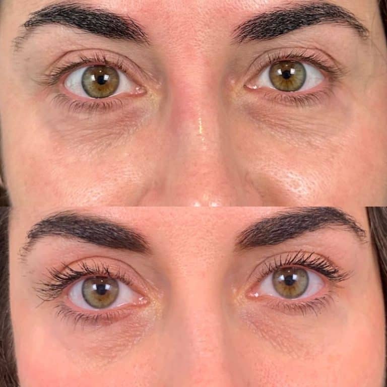 Neogen - Vega Vitality